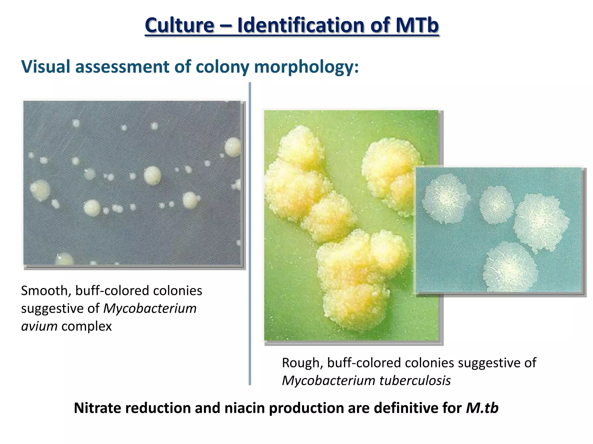 Diagnosis of Tuberculosis | PPTX