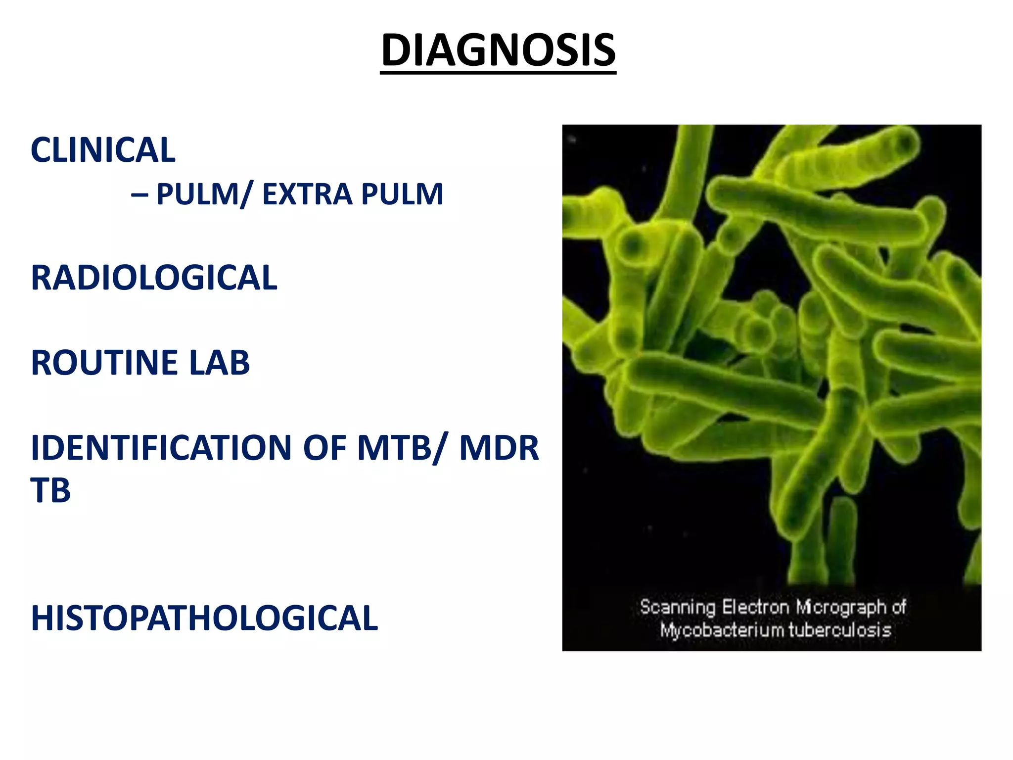 Diagnosis of Tuberculosis | PPTX