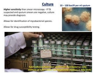 Diagnosis of Tuberculosis | PPTX