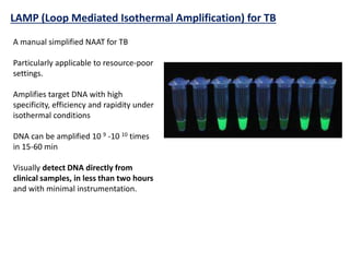 Diagnosis of Tuberculosis | PPTX