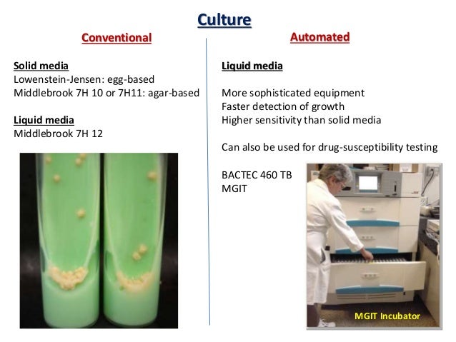 Diagnosis of Tuberculosis