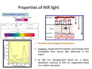 Diagnosis of testicular torsion using near infrared spectroscopy | PPTX