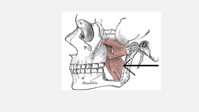DIAGNOSIS of Temporo Mandibular Diseases | PPT