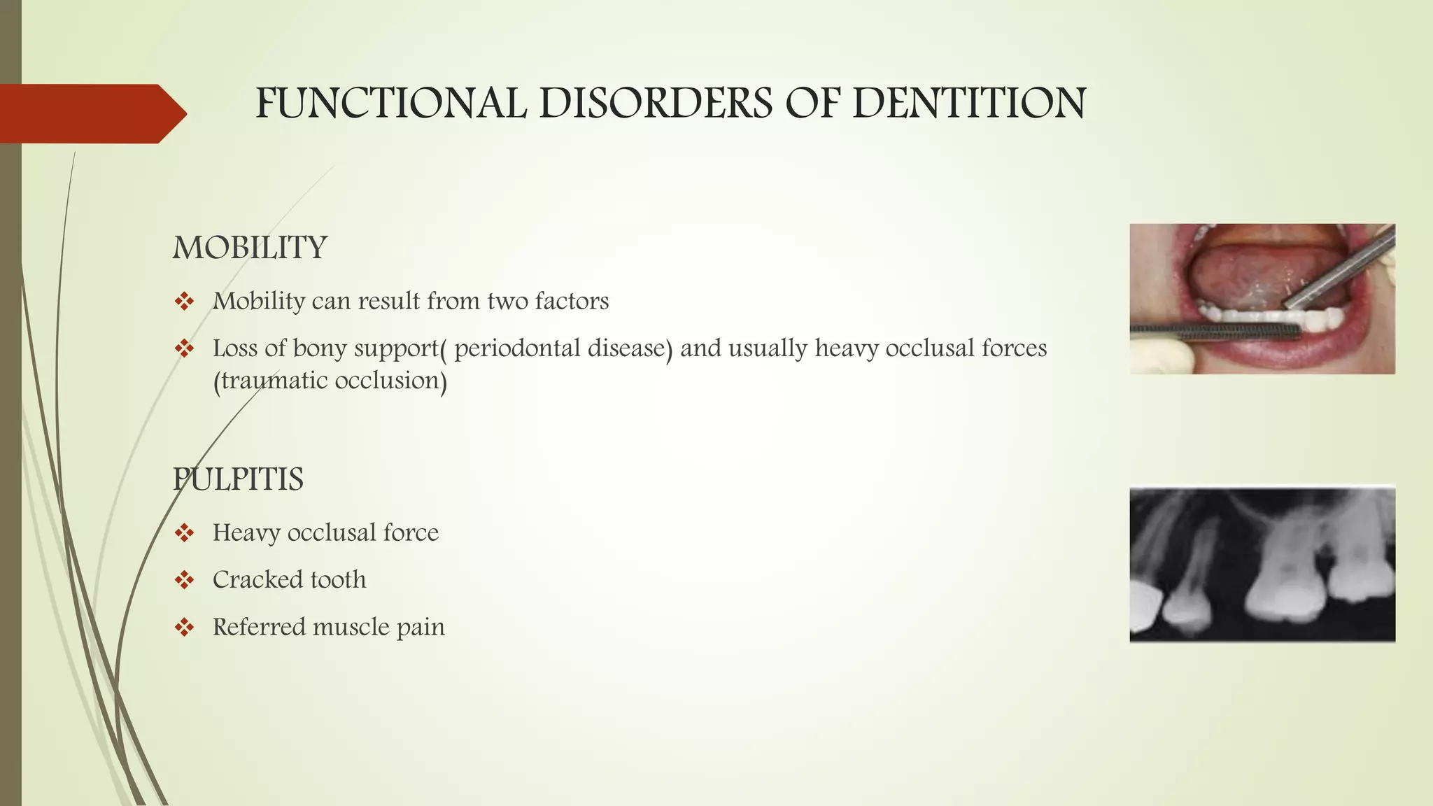 diagnosis of TMJ.pptx