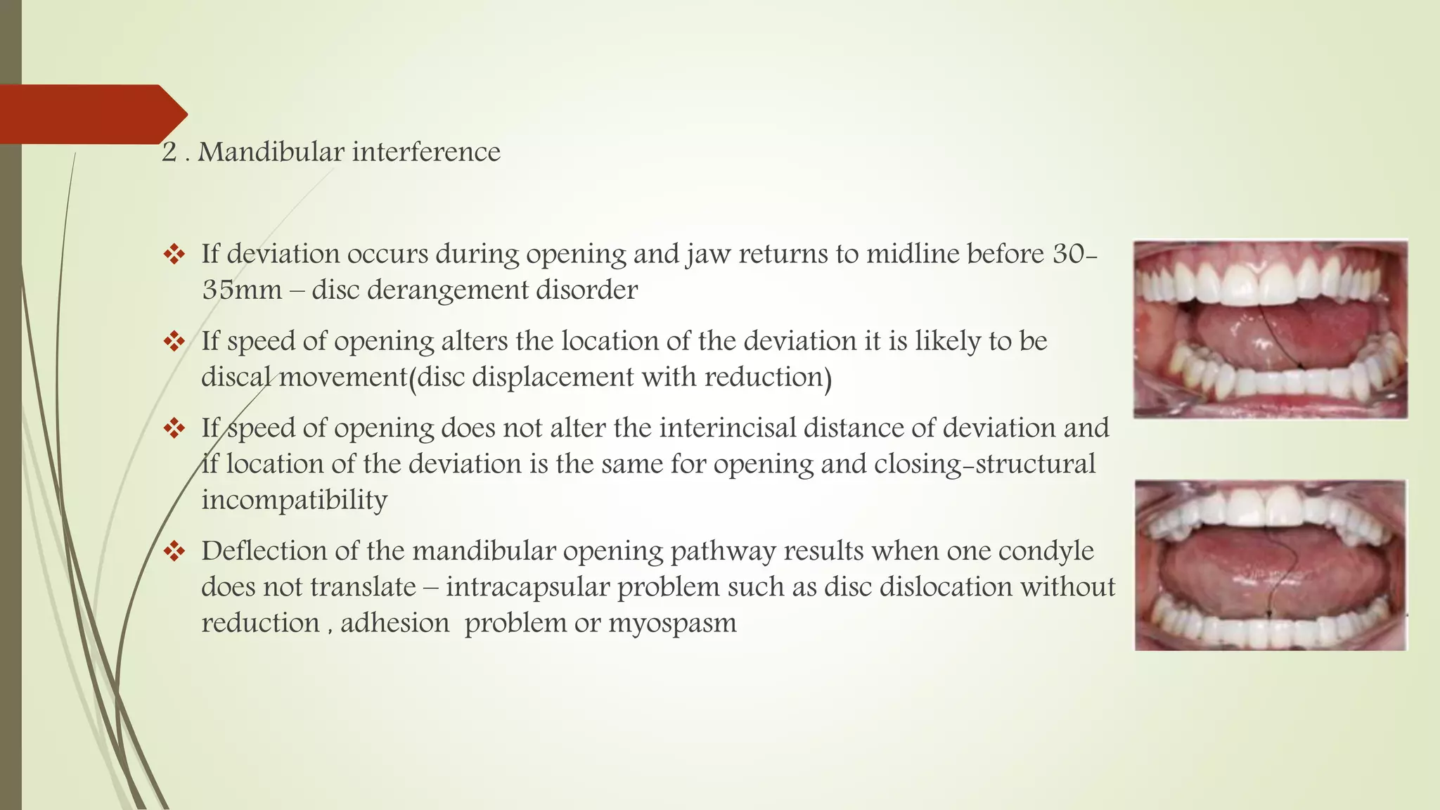 diagnosis of TMJ.pptx