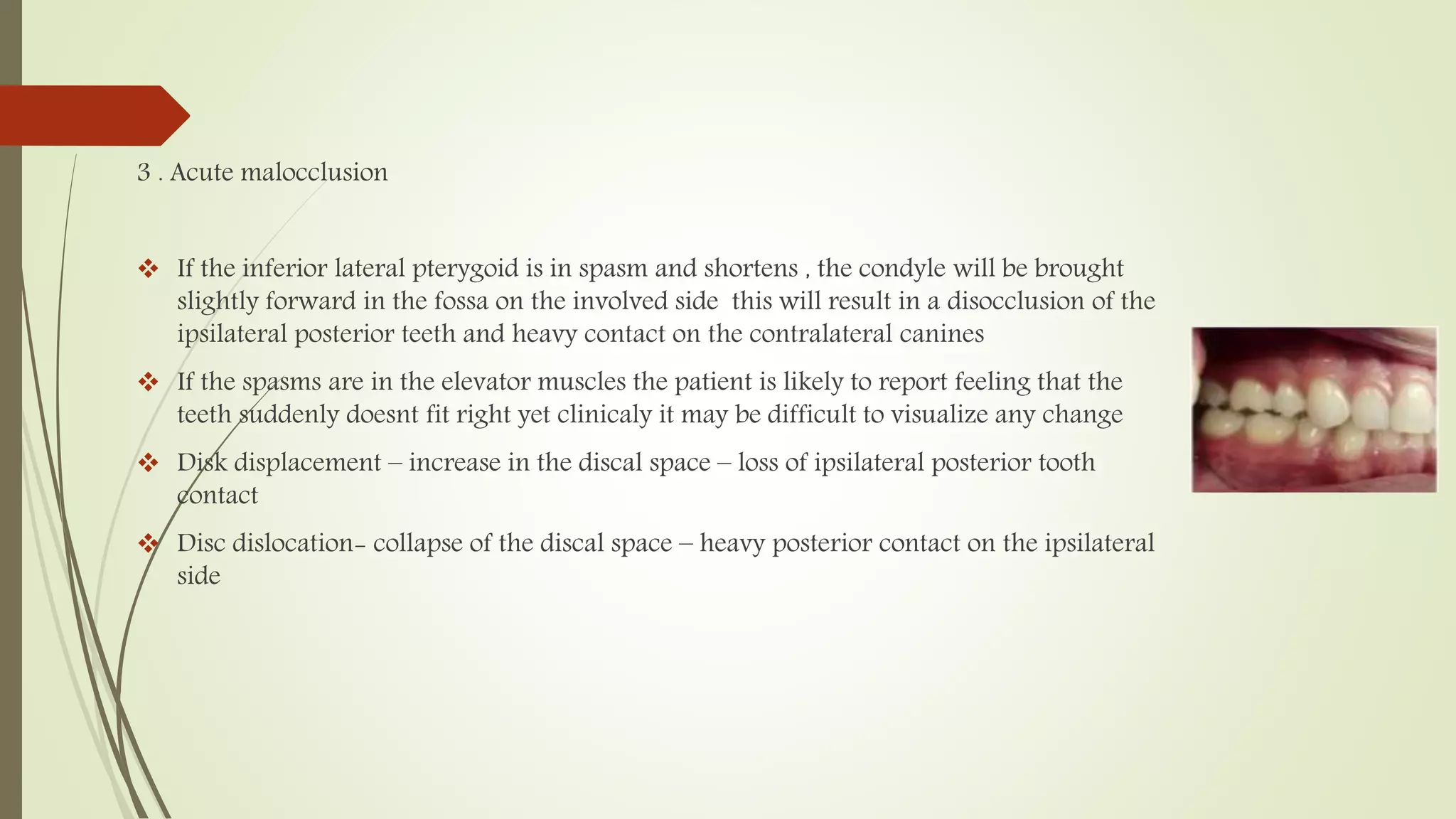 diagnosis of TMJ.pptx