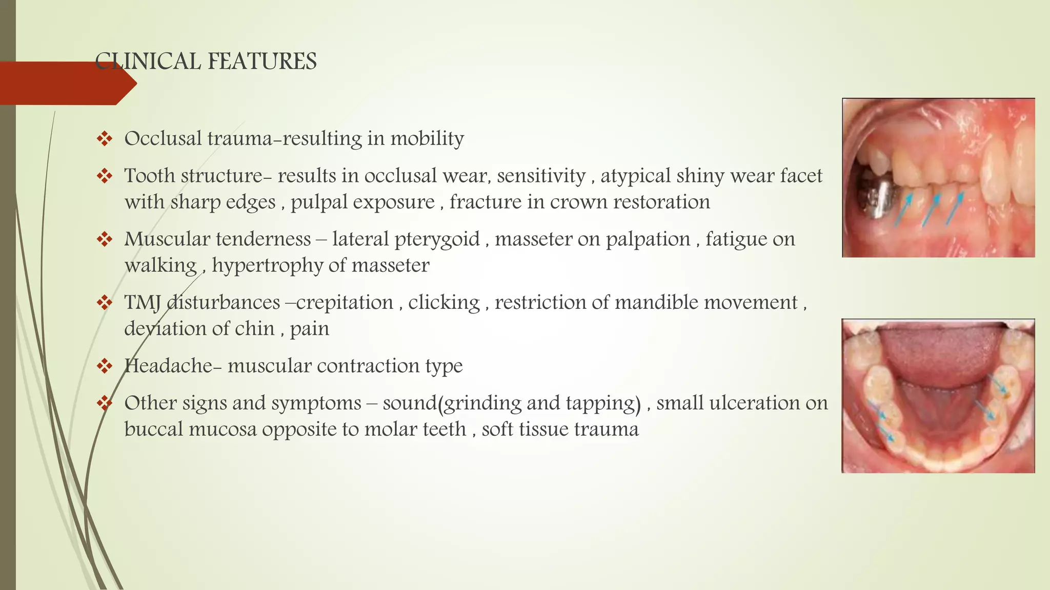 diagnosis of TMJ.pptx