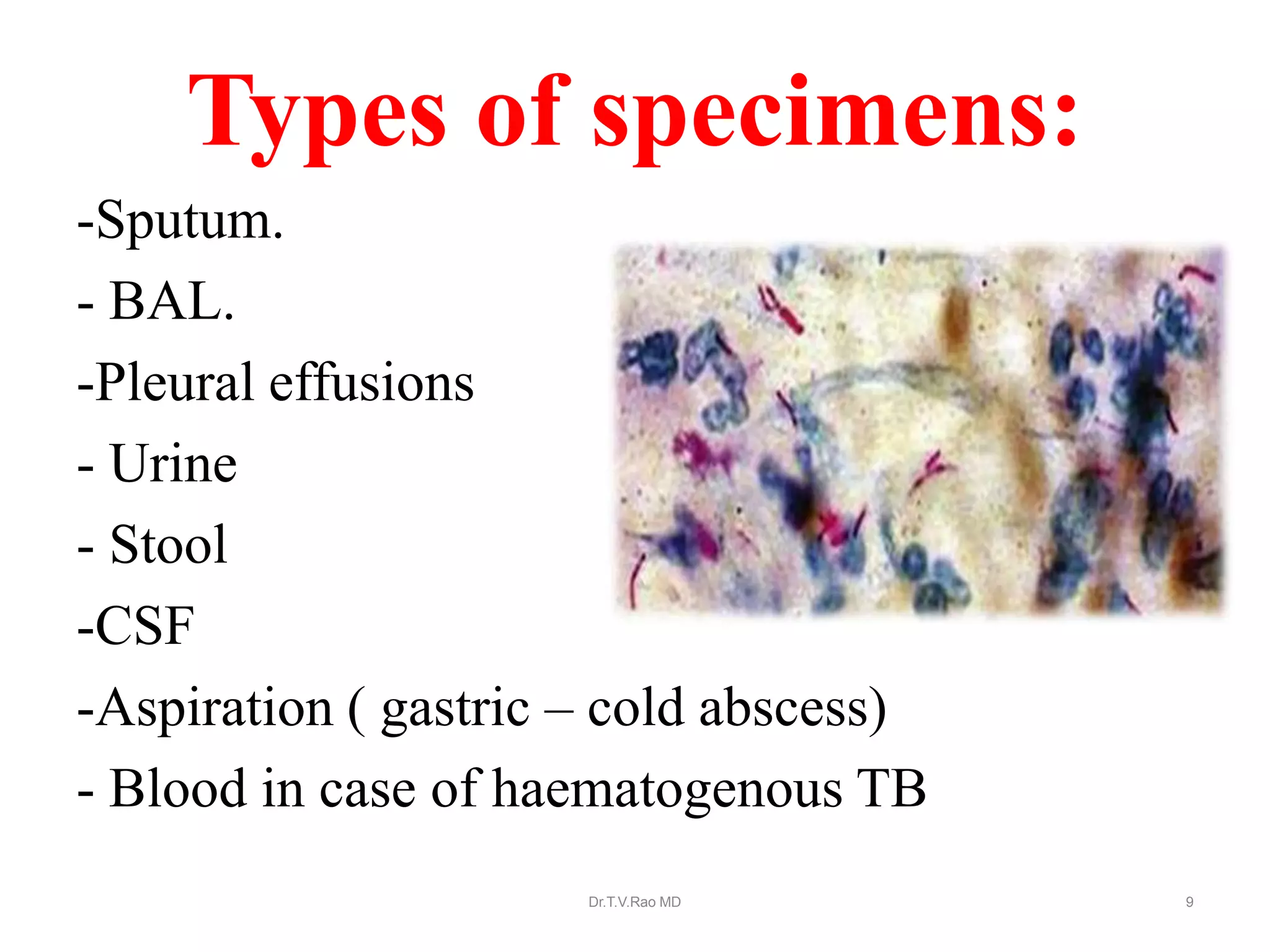 Diagnosis of Tuberculosis an Update | PPTX