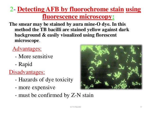 Diagnosis of Tuberculosis an Update