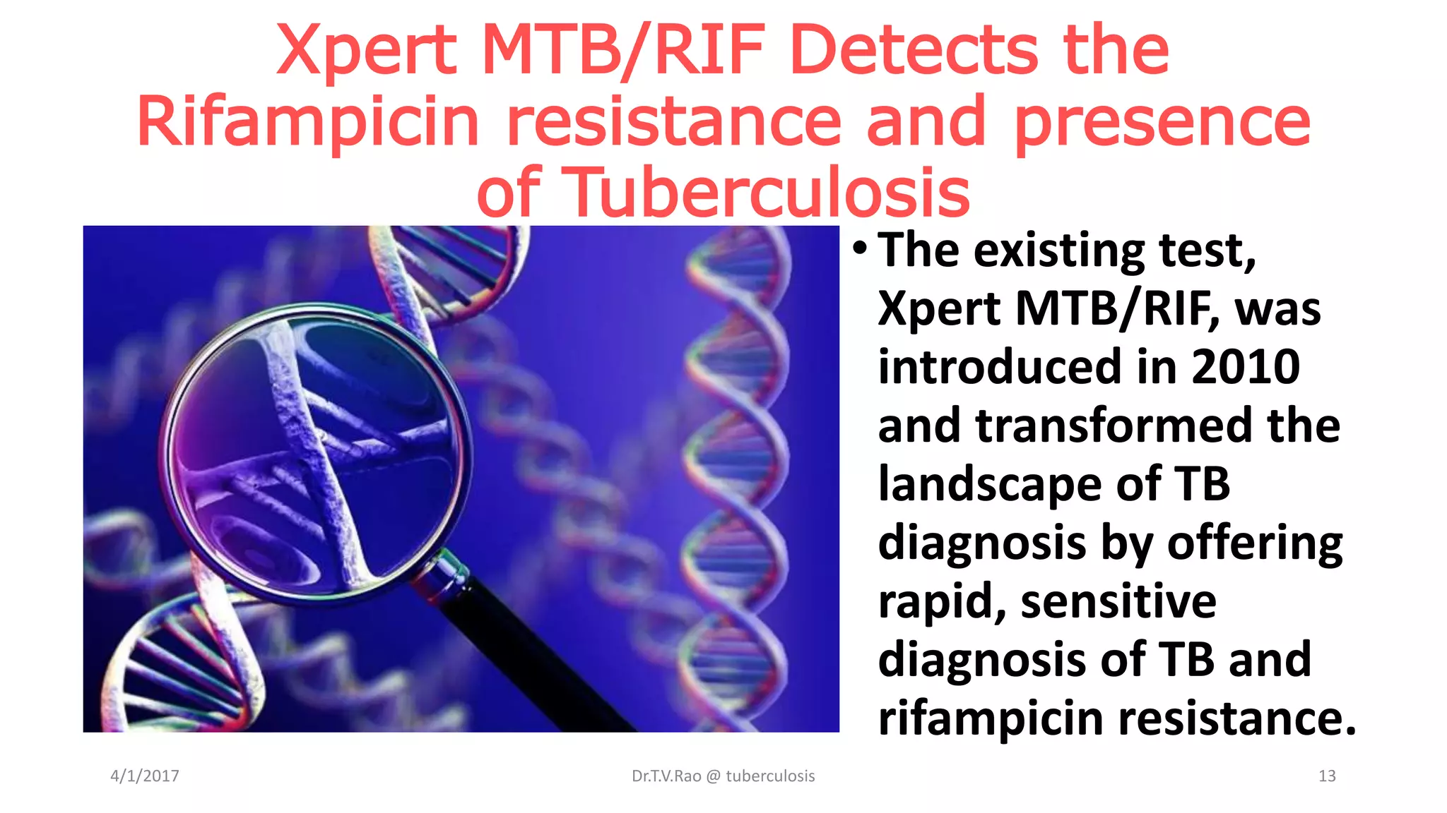 Xpert MTB/RIF Ultra newer technology past to future DIAGNOSIS OF ...