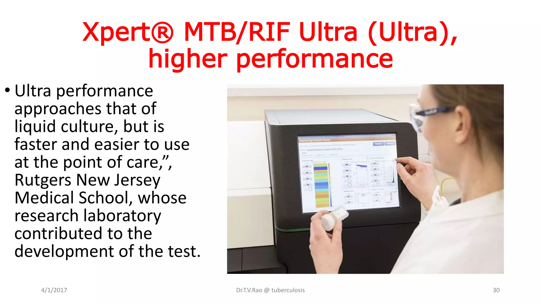Xpert MTB/RIF Ultra newer technology past to future DIAGNOSIS OF ...