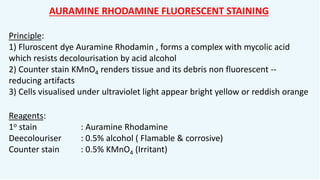 Diagnosis of tuberculosis | PPT