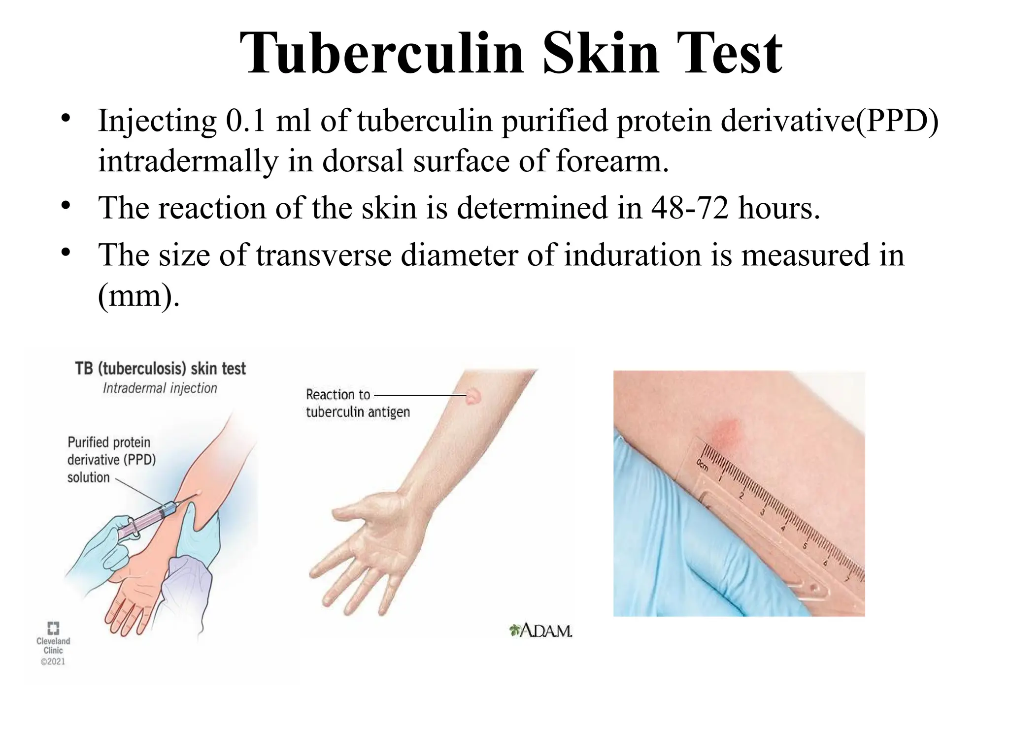 Diagnosis of Tuberculosis( General medicine) | PPTX