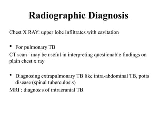 Diagnosis of Tuberculosis( General medicine) | PPTX