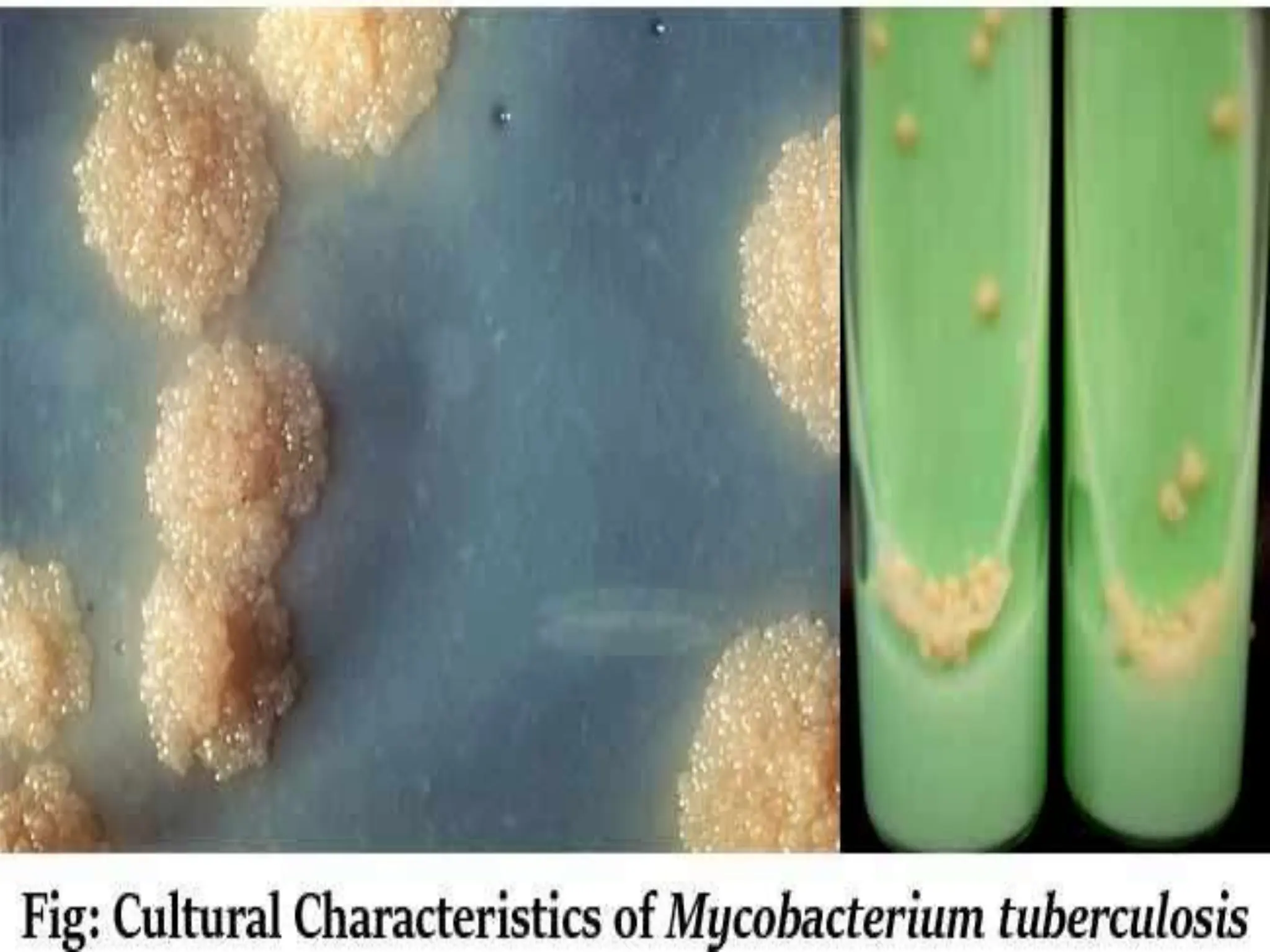 DIAGNOSIS OF TUBERCULOSIS, NEWER TECHNIQUES, TST.pptx