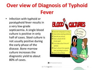 DIAGNOSIS OF TYPHOID FEVER | PPTX