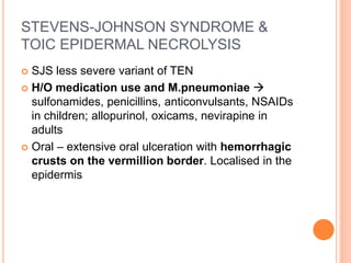 Diagnosis of ulcerative, vesicular and bullous lesion | PPTX