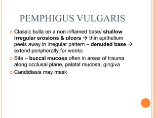 Diagnosis of ulcerative, vesicular and bullous lesion | PPTX