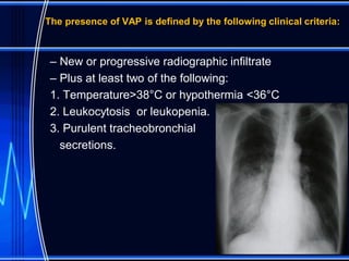 Diagnosis of ventilator associated pneumonia | PDF