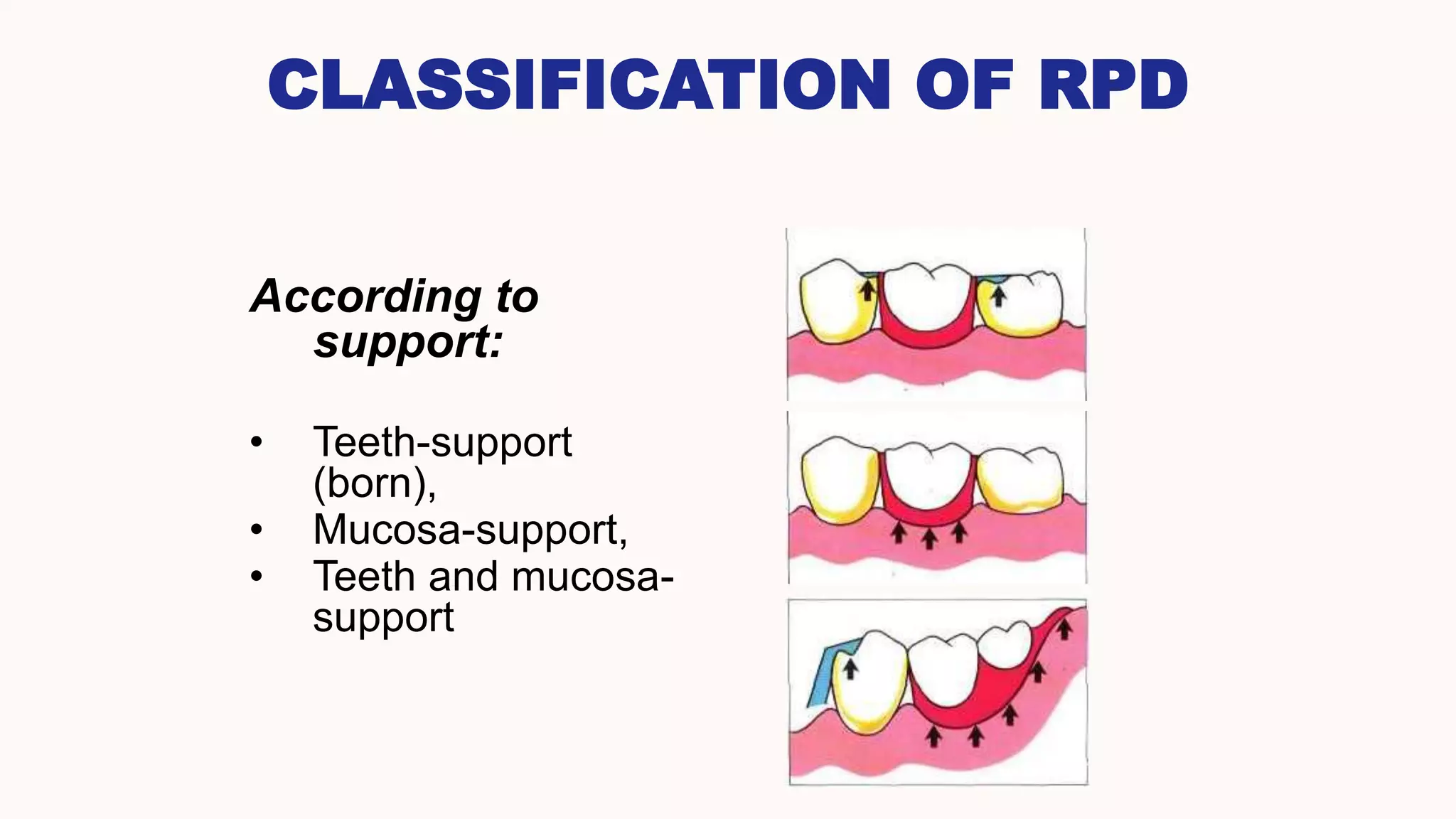 diagnosis rpd.pptx