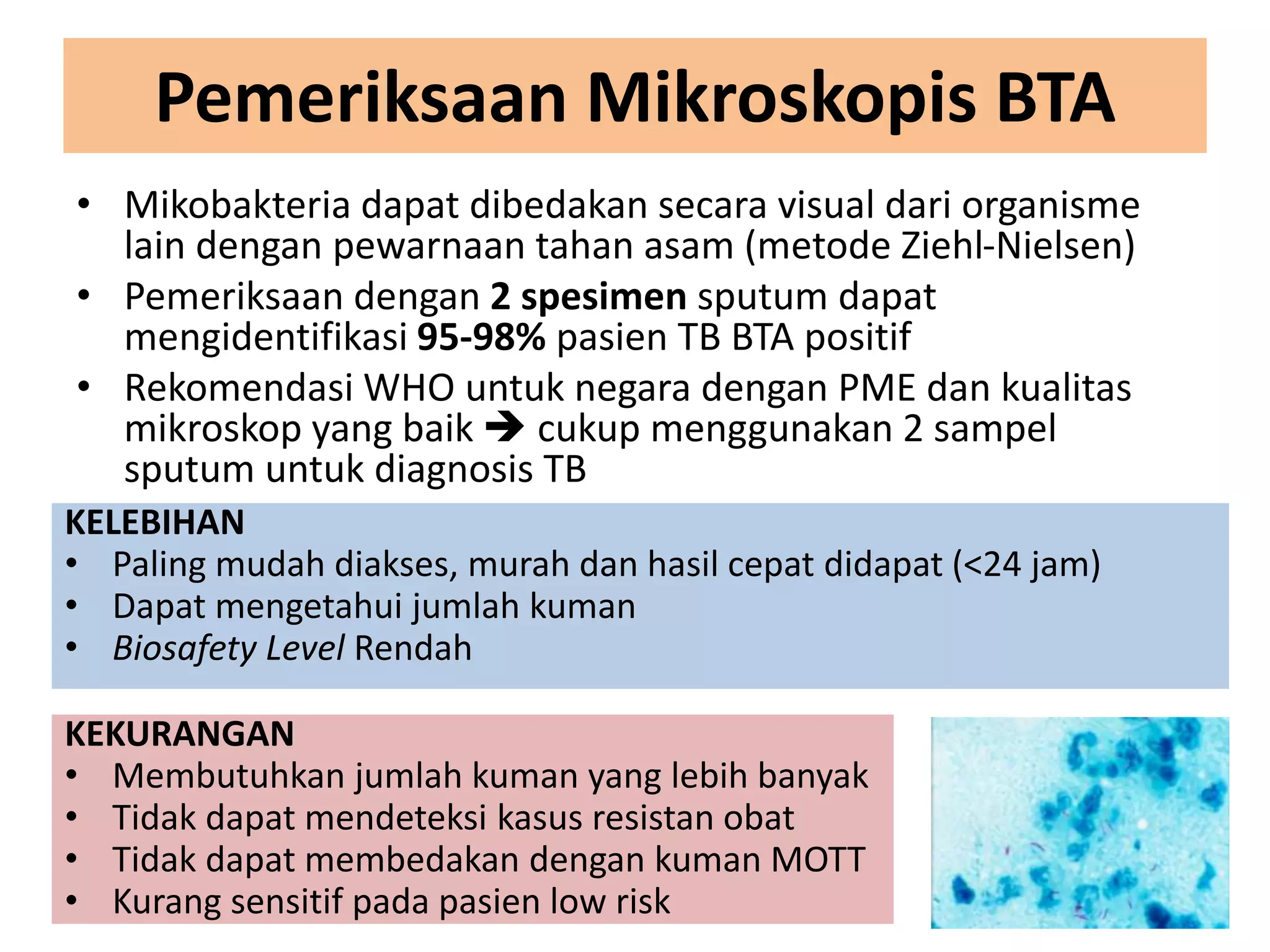 DIAGNOSIS TB MDR.ppt