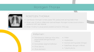 DIAGNOSIS TUBERKULOSIS ANAK DAN REMAJA-3.pdf