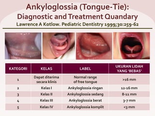 Diagnosis tongue tie & indikasi frenektomi | PPT