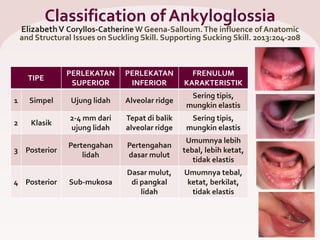 Diagnosis tongue tie & indikasi frenektomi