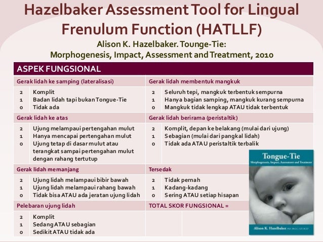 Diagnosis tongue tie & indikasi frenektomi