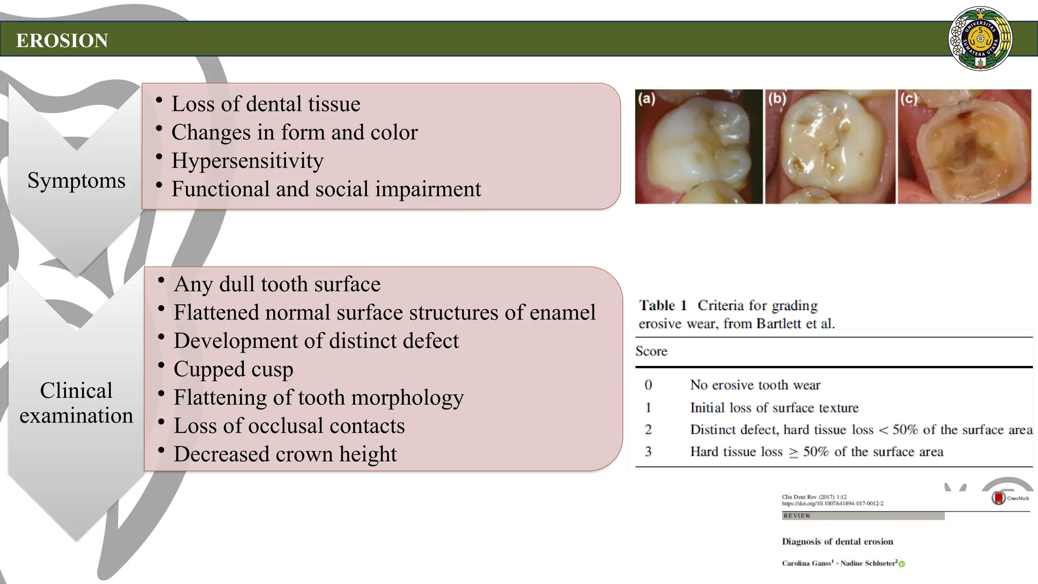 DIAGNOSIS TOOTH WEAR chemical and physical | PPTX
