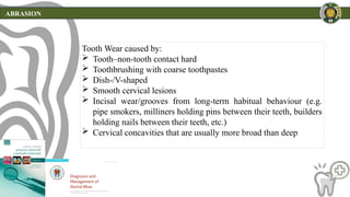 DIAGNOSIS TOOTH WEAR chemical and physical | PPTX