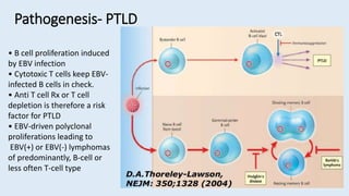 Diagnosis & treatment of ptld dr keniz | PPTX | Infectious Diseases ...