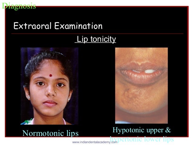 Diagnosis & treatment planning