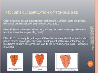 Diagnosis & Treatment Planning In Complete denture By Dr Anmol Asghar ...