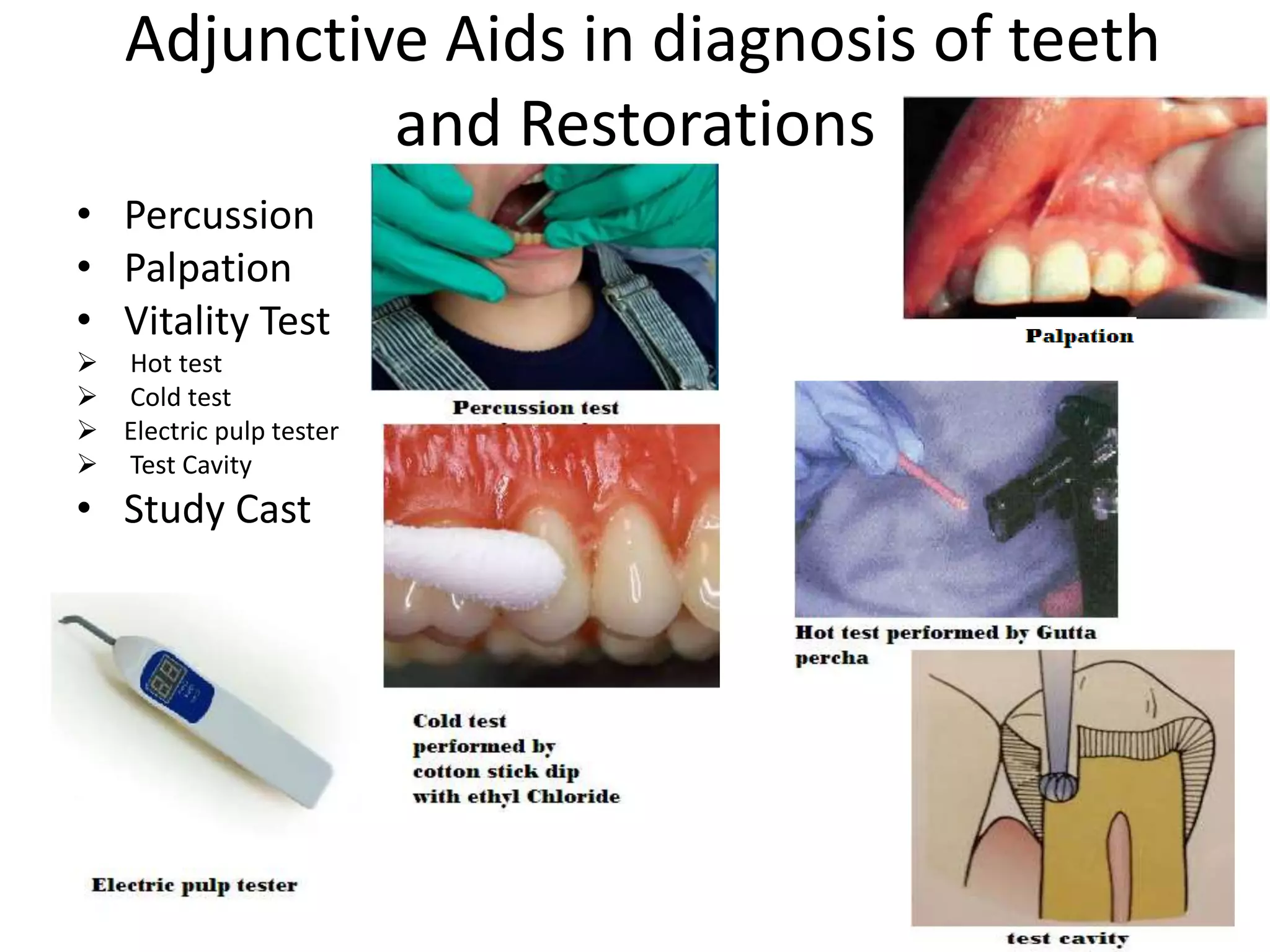 Diagnosis &treatment planning in conservative dentistry dr arsalan | PPTX