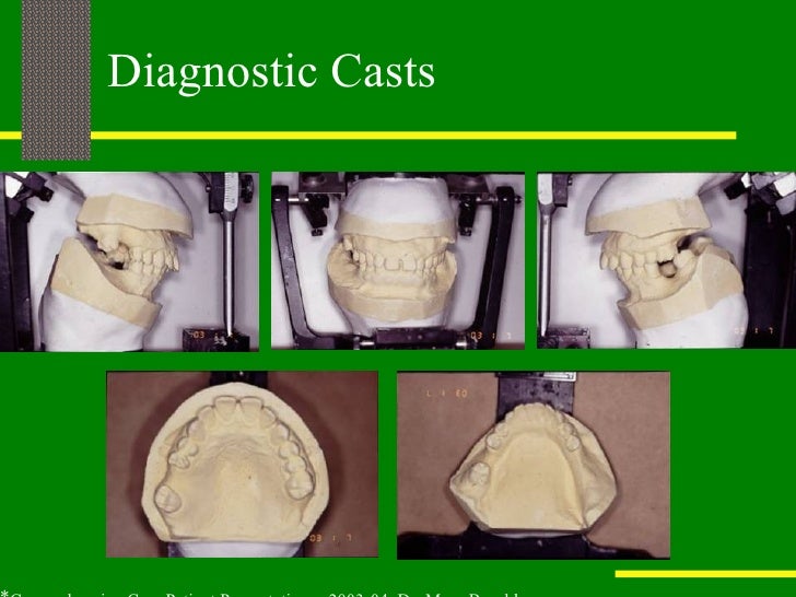 Diagnosis&Treatment Planningin Fpd