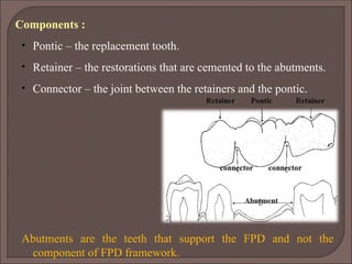 Diagnosis & Treatment Planning in fixed partial denture | PPT