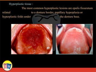 diagnosis___treatment_planning__perio_.ppt