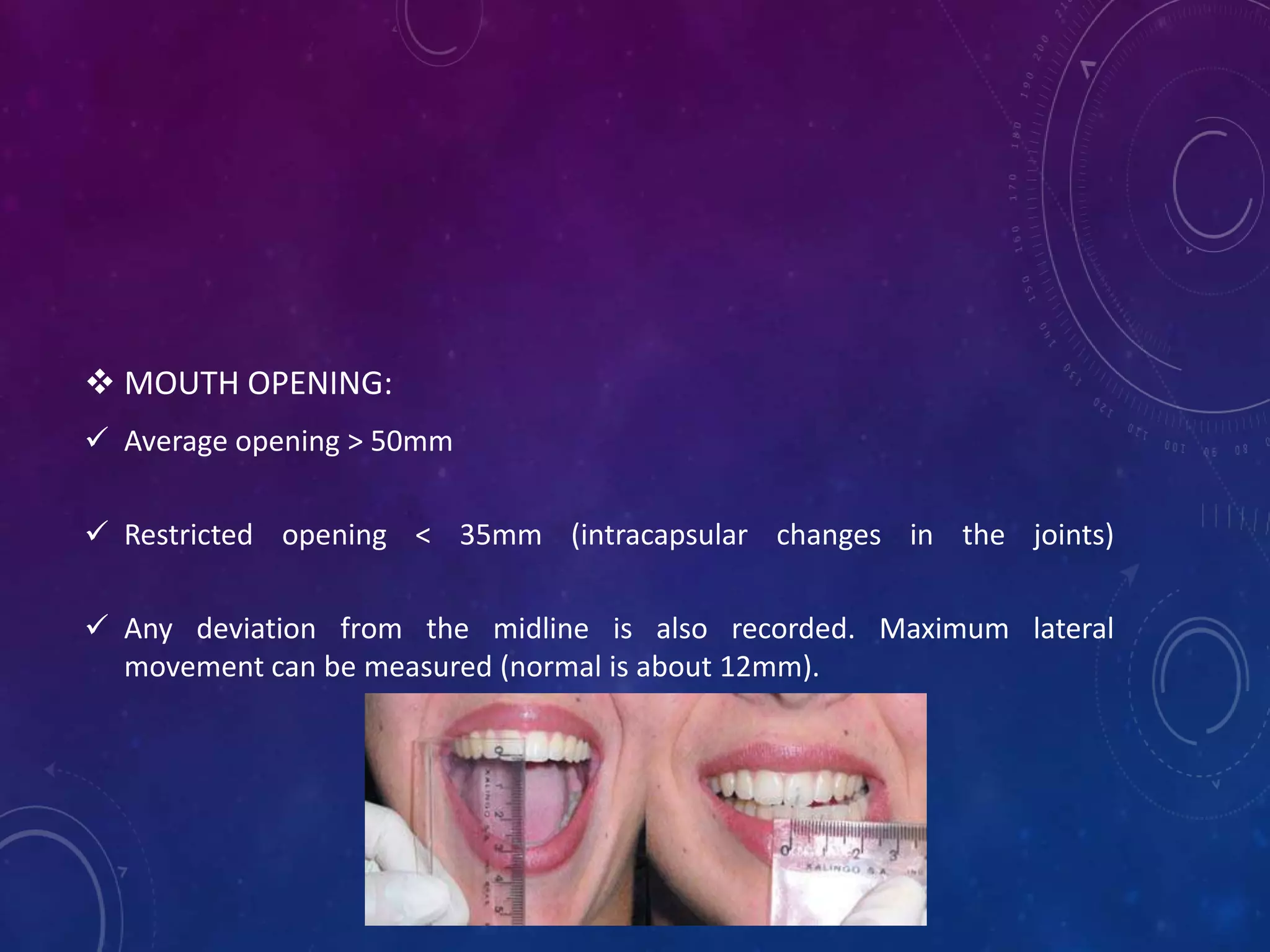 Diagnosis & Treatment Planning in FPD | PPTX