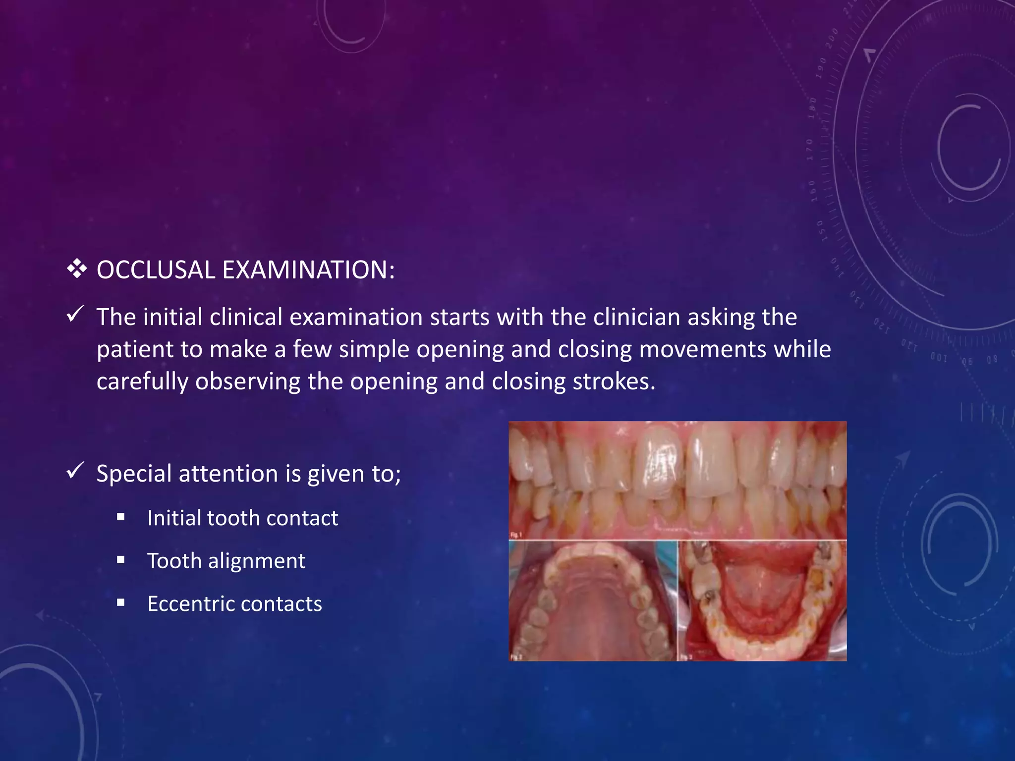 Diagnosis & Treatment Planning in FPD | PPTX