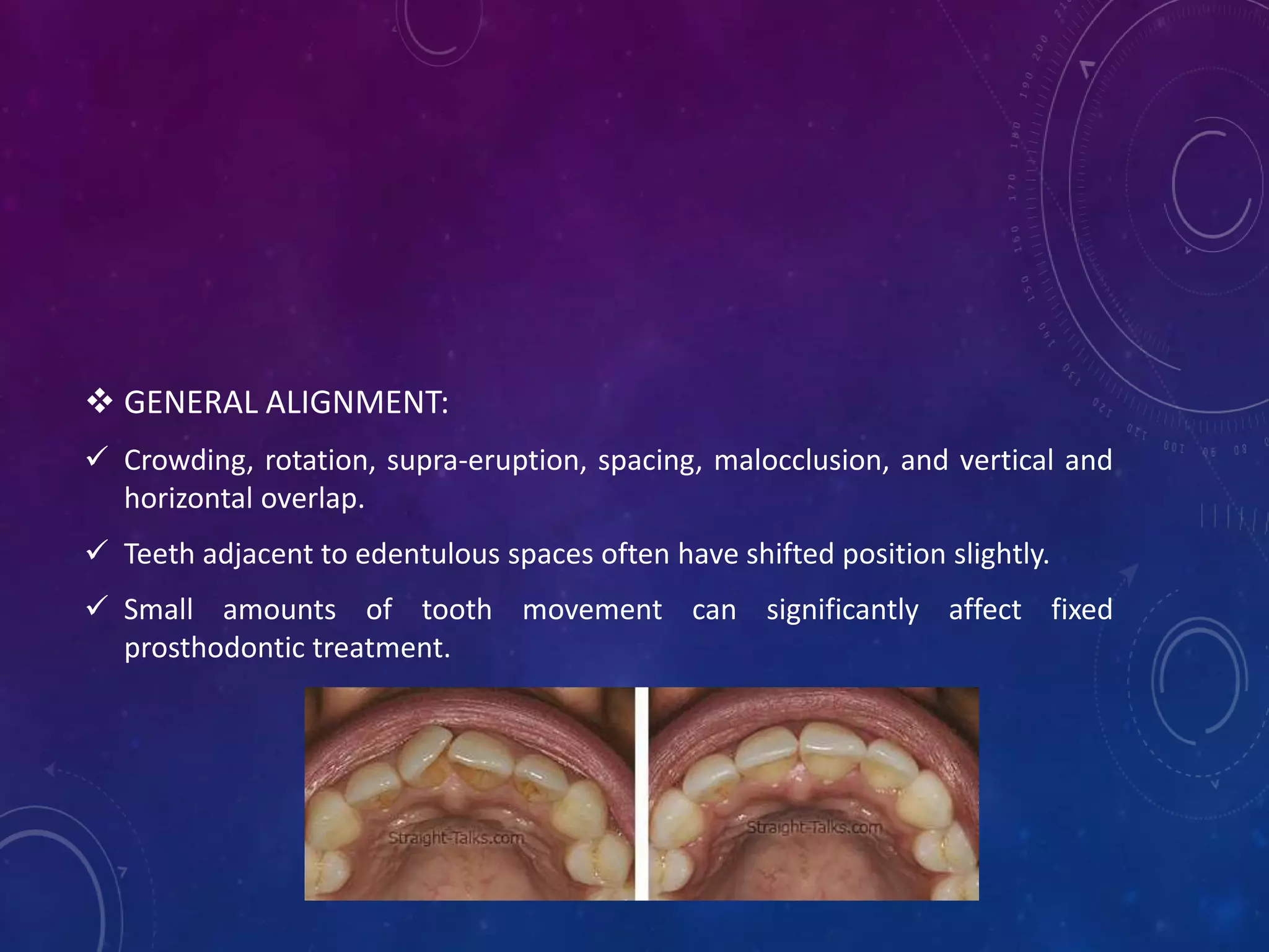 Diagnosis & Treatment Planning in FPD | PPTX