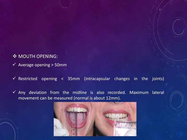 Diagnosis & Treatment Planning in FPD | PPTX