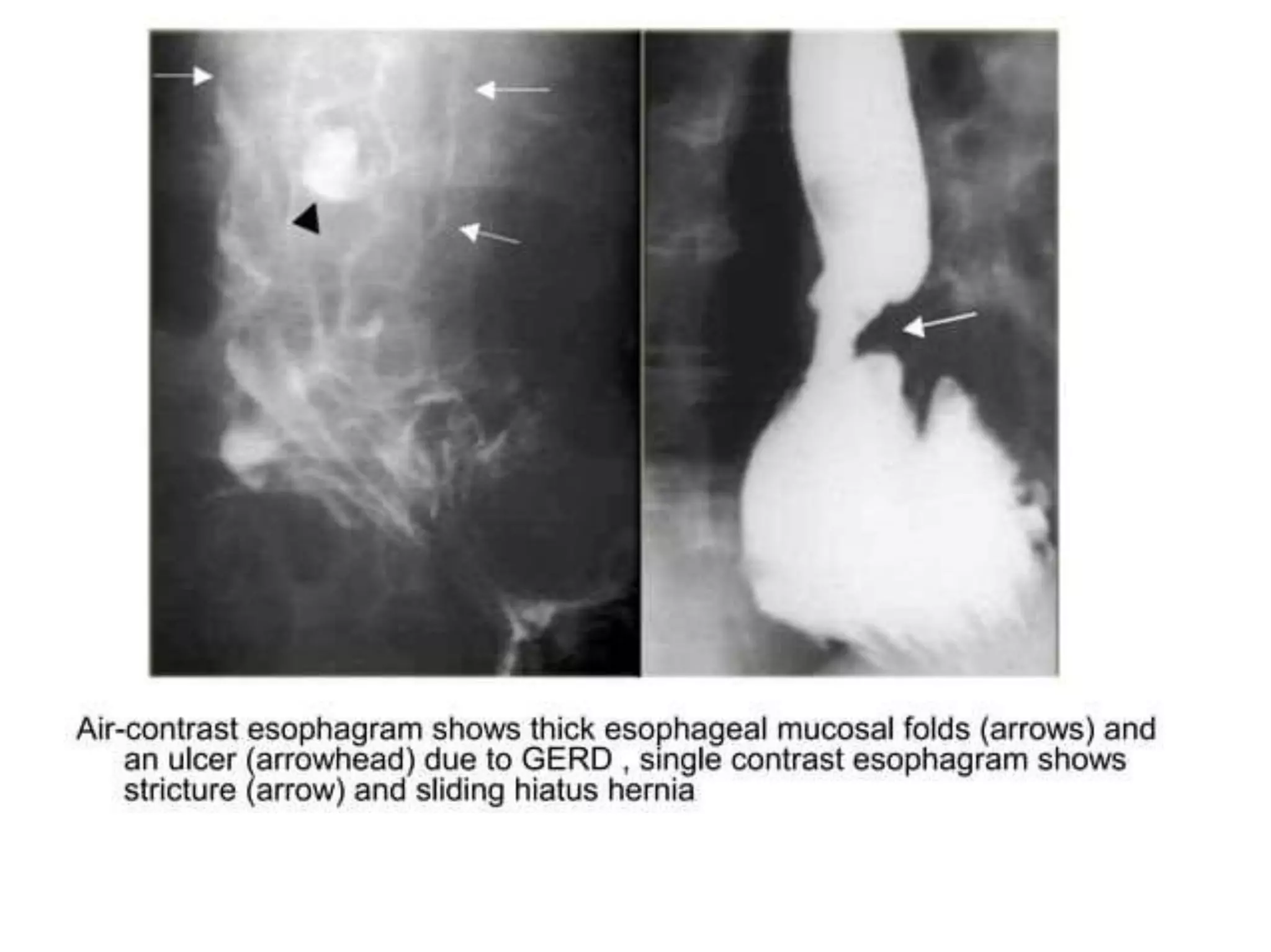 diagnositc-imaging-of-the-esophagus.pptx