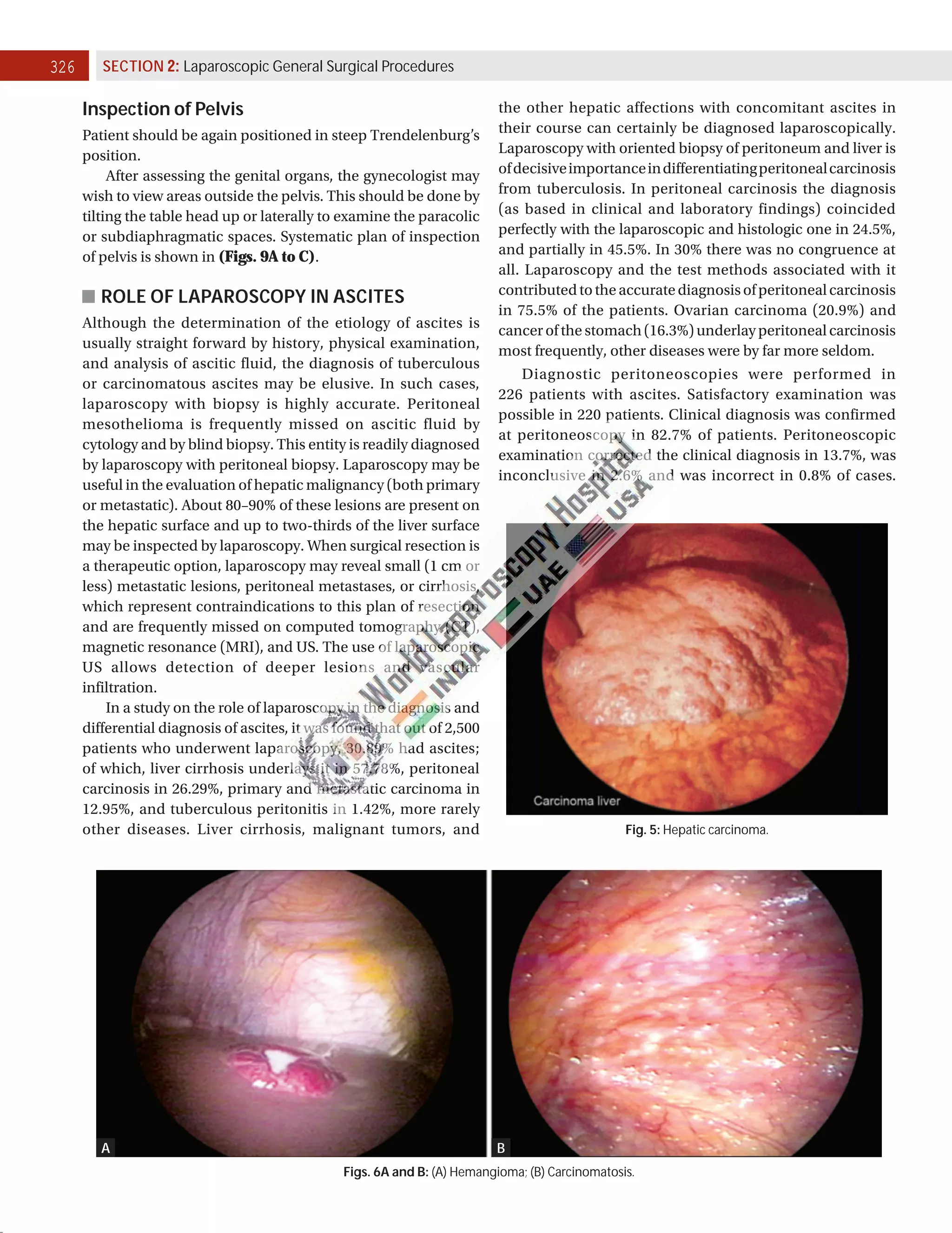Diagnostic Laparoscopy | PDF
