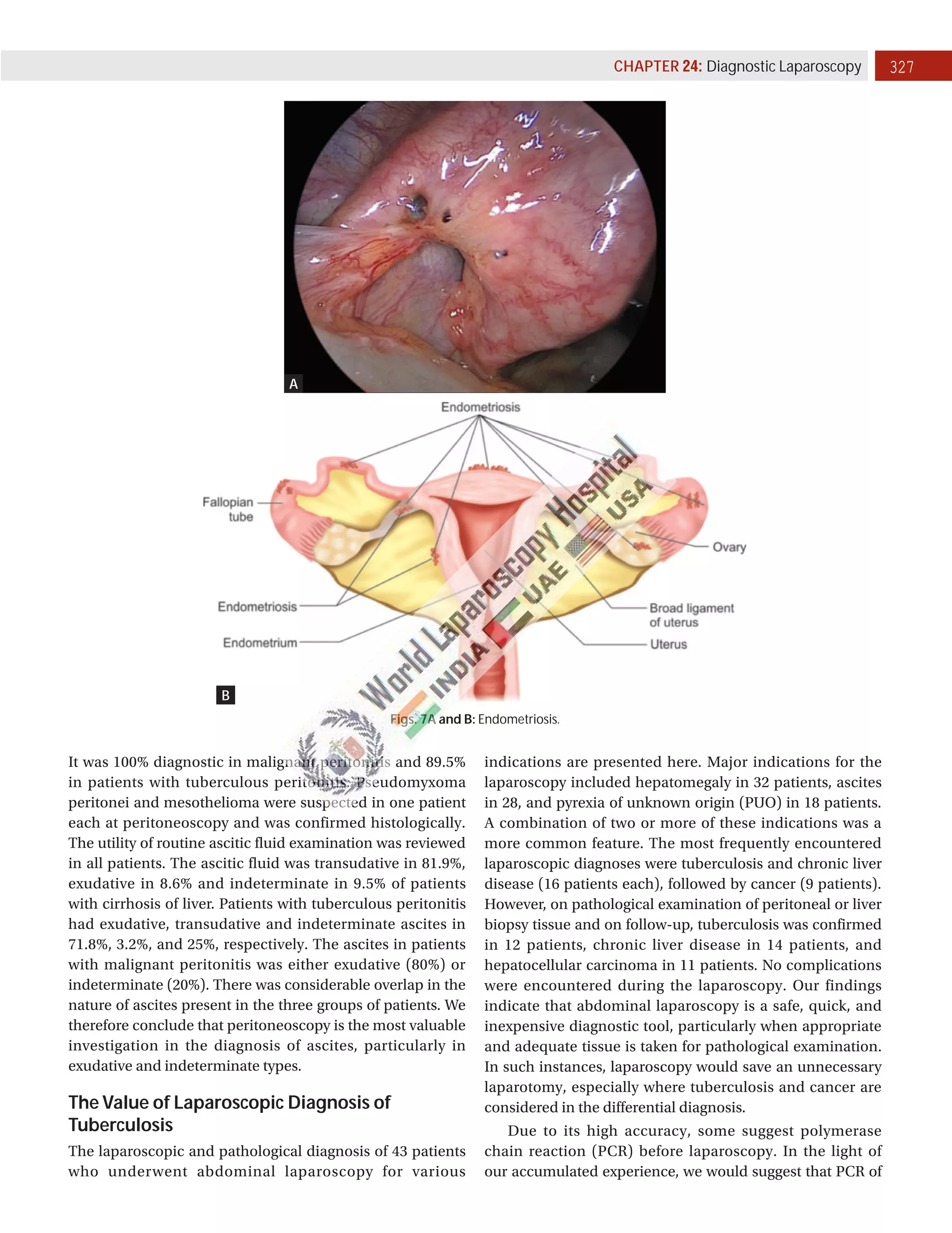 Diagnostic Laparoscopy | PDF