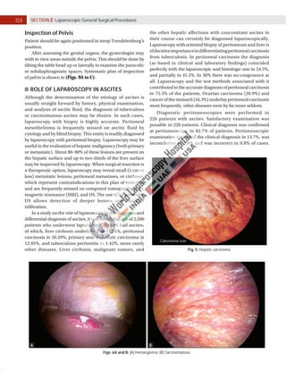 Diagnostic-Laparoscopy.pdf