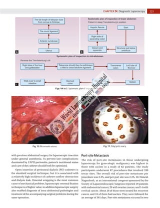 Diagnostic-Laparoscopy.pdf