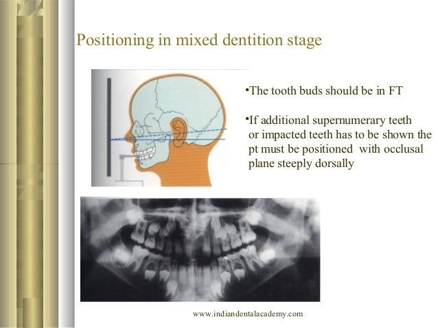 Diagnostic setup. opg, xeroradiography,clarks technique /certified fi…