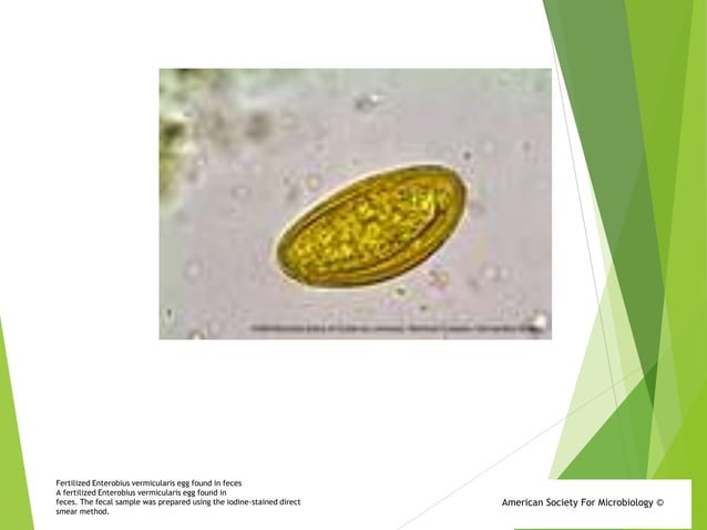 Diagnostic-Structures-Of-Enterobius-Vermicularis.pptx