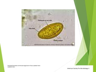 Enterobius Vermicularis Labeled